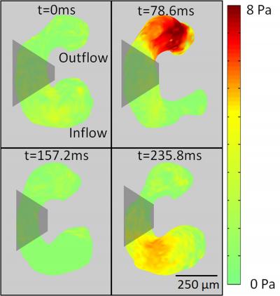 Shear Stress Map [IMAGE] | EurekAlert! Science News Releases