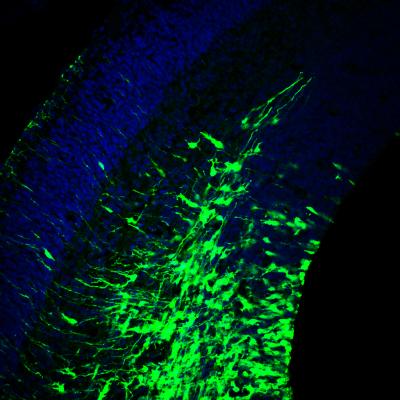 Botch in the Brain [IMAGE] | EurekAlert! Science News Releases