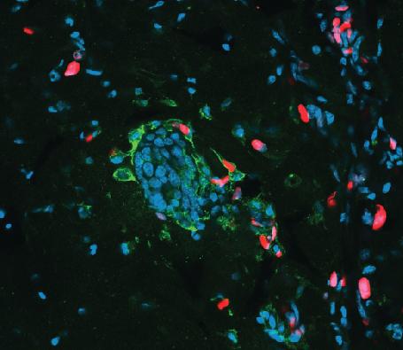 Chemotherapy-Treated Cancer Ce [IMAGE] | EurekAlert! Science News Releases