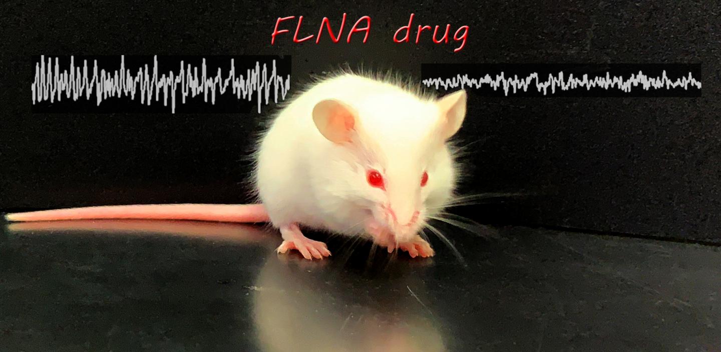 Correcting Cortical Defects An [image] Eurekalert Science News Releases