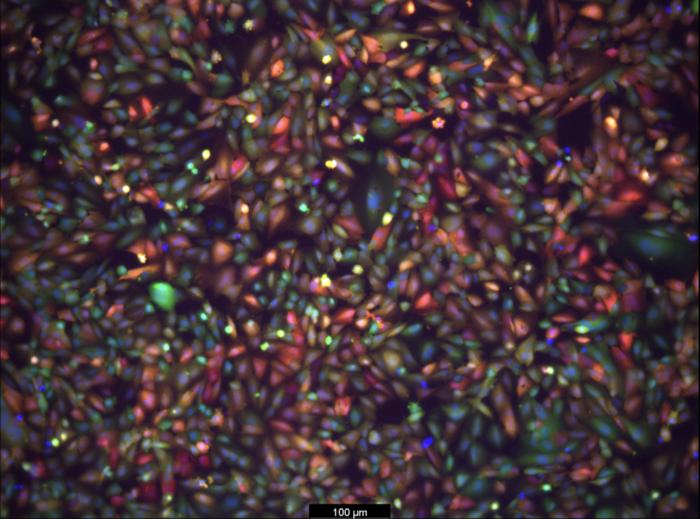 Mitchell Han main mCherry imag [IMAGE] | EurekAlert! Science News Releases