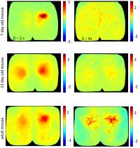 New view of brain development: Striking diffe | EurekAlert!