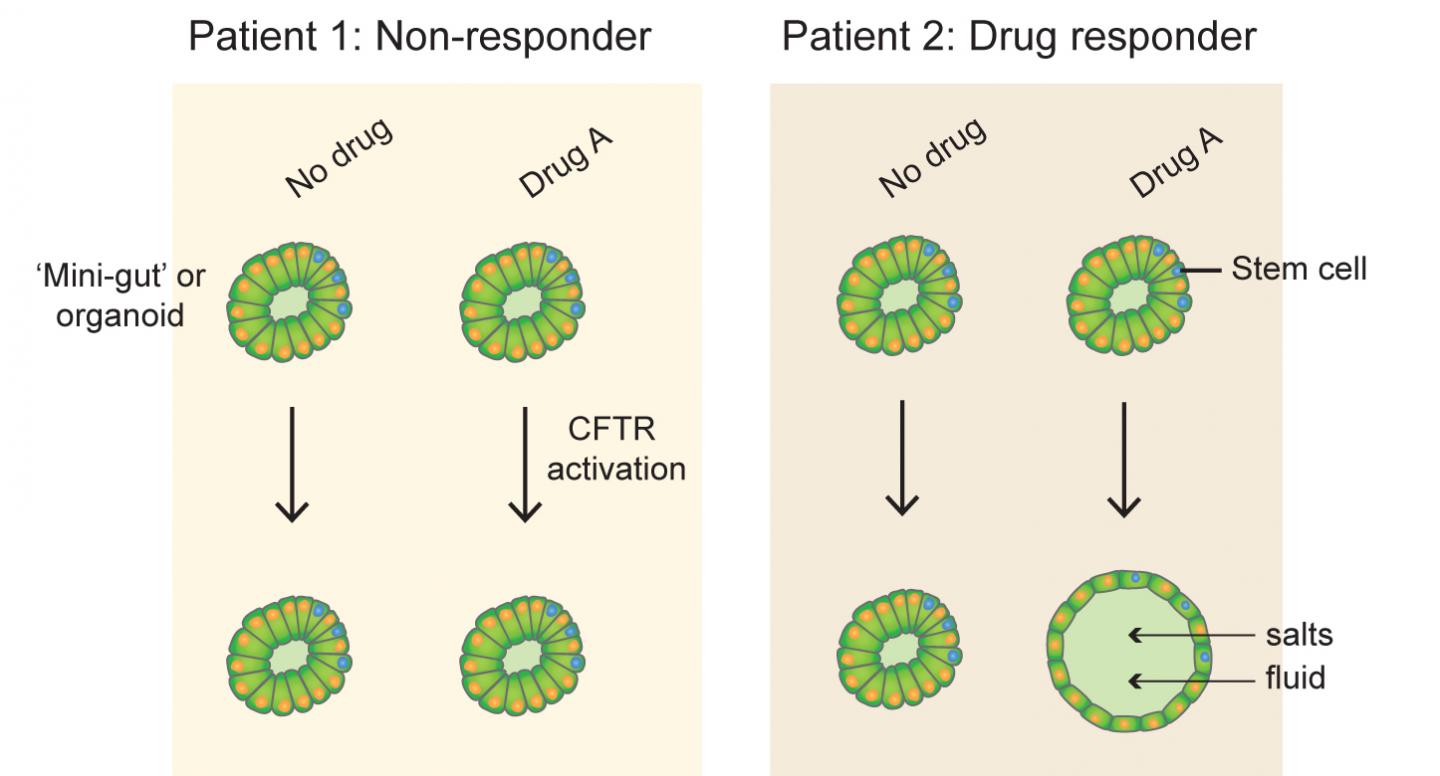 Mini-Guts Predict Cystic Fibro [IMAGE] | EurekAlert! Science News Releases