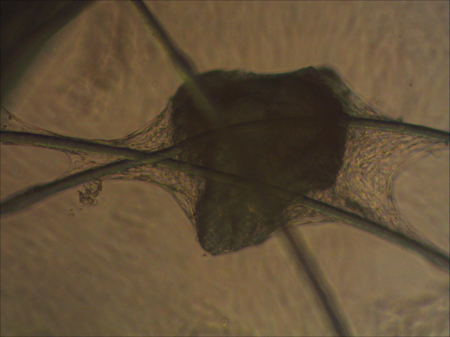 Human Bone Cells on a Scaffold [IMAGE] | EurekAlert! Science News Releases