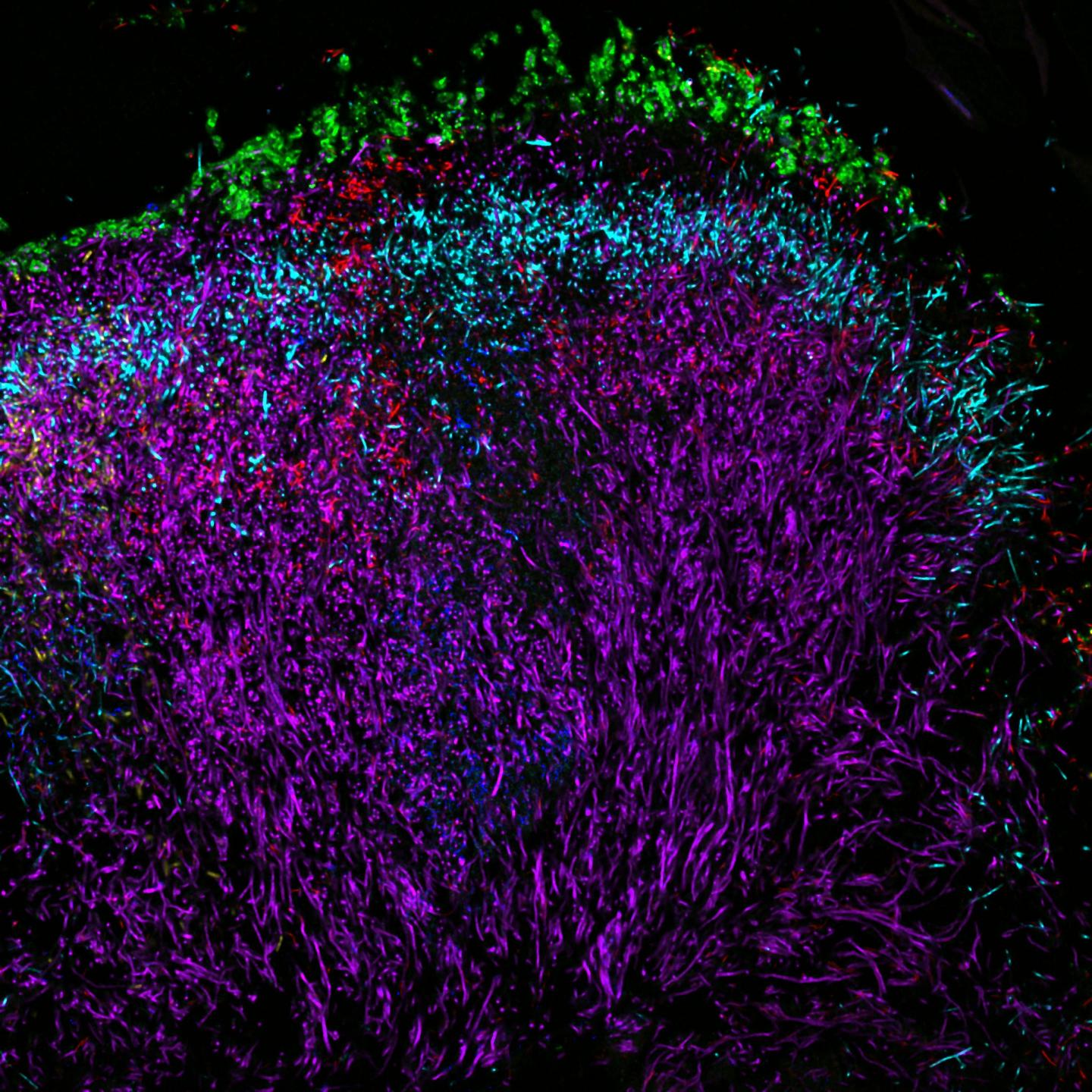 Hedgehog Structure in Dental P [IMAGE] | EurekAlert! Science News Releases