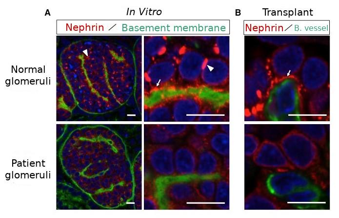 Filtration Membrane Precursors [IMAGE] | EurekAlert! Science News Releases