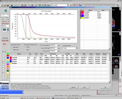 Dose-Volume Histogram [IMAGE] | EurekAlert! Science News Releases