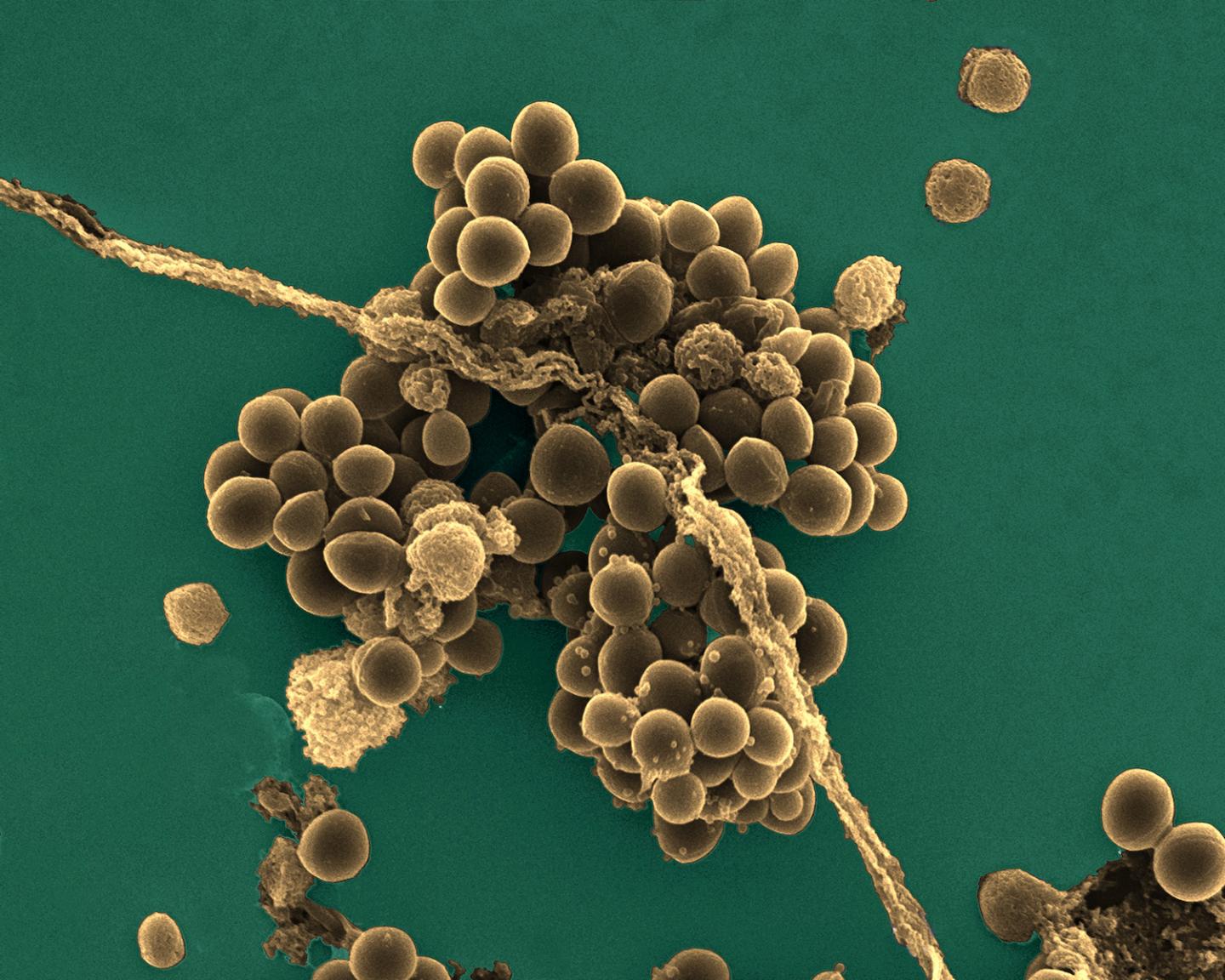 Staphylococcus aureus: A new mechanism involv | EurekAlert!