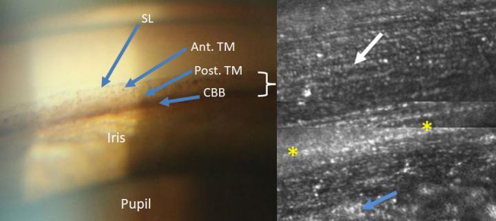Telescope technology used to take first accur | EurekAlert!