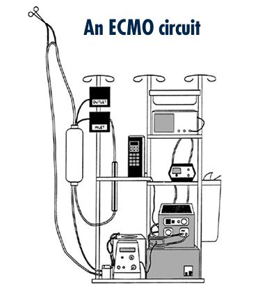 ECMO Circuit [IMAGE] | EurekAlert! Science News Releases