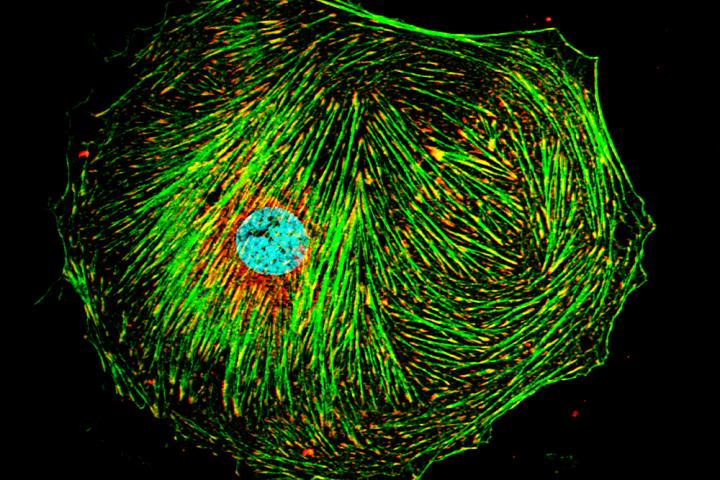 Stellate Cell Focal Adhesions [IMAGE] | EurekAlert! Science News Releases