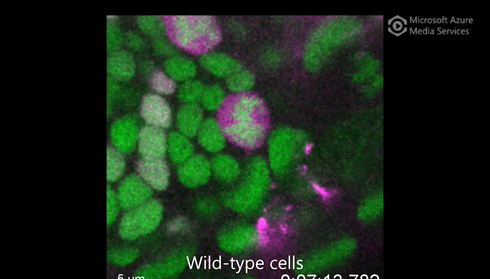 A mutated eye offers a glimpse of a key prote | EurekAlert!