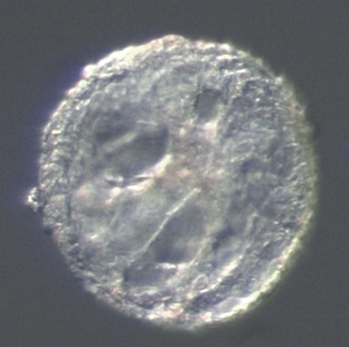 Pancreas Organoid [IMAGE] | EurekAlert! Science News Releases