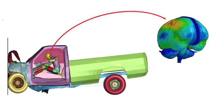 TBI Car Crashes [IMAGE] | EurekAlert! Science News Releases