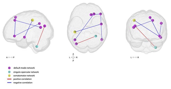 Brain connectivity over time [IMAGE] | EurekAlert! Science News Releases