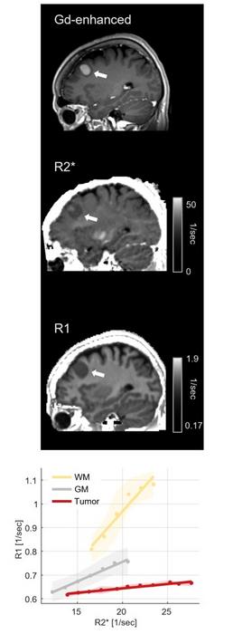 MRI image with contrast agent [IMAGE] | EurekAlert! Science News Releases
