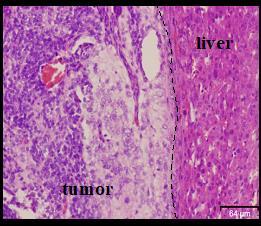 New model shows how cells that cause liver ca | EurekAlert!