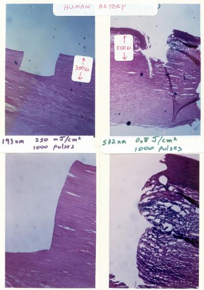 Micrographs of Human Aorta [IMAGE] | EurekAlert! Science News Releases