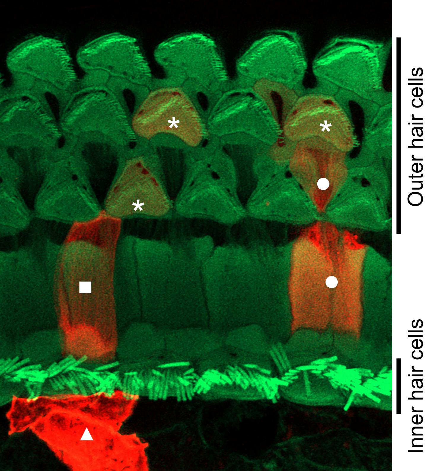Figure 2: Nox3 expressing cell [IMAGE] | EurekAlert! Science News Releases