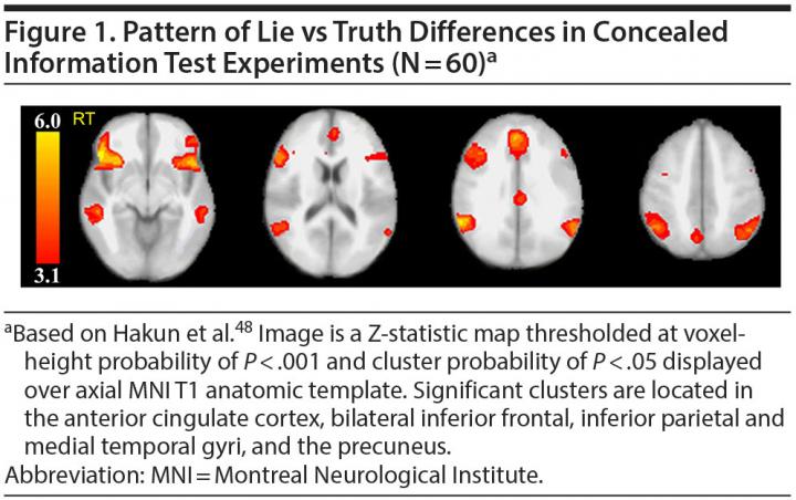 Pattern of Lie vs Truth Differ [IMAGE] | EurekAlert! Science News Releases