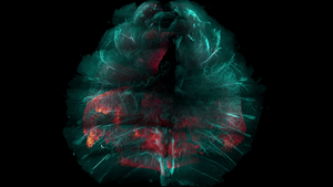 New method for making tissue transparent coul | EurekAlert!