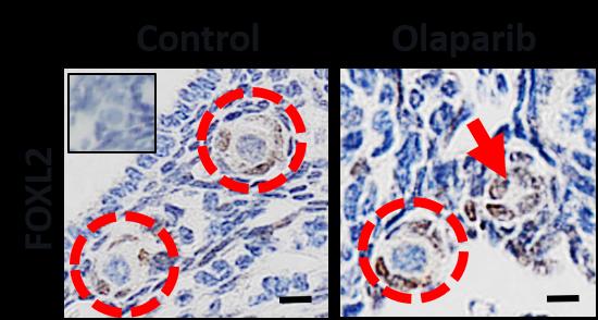 Breast Cancer Drug, Olaparib, [IMAGE] | EurekAlert! Science News Releases