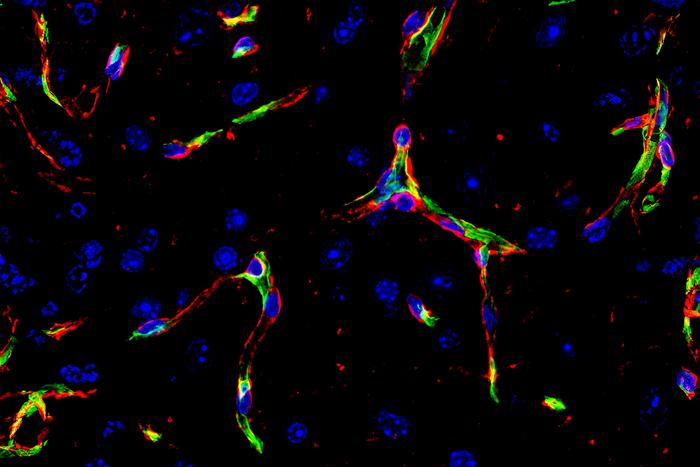 Blood vessel endothelial cells [IMAGE] | EurekAlert! Science News Releases