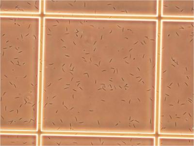 A New Era of Malaria Vaccine D [IMAGE] | EurekAlert! Science News Releases