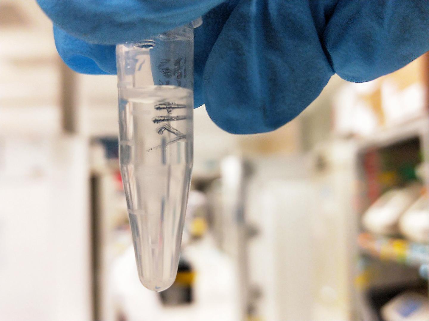 Over one in 3 rare childhood disorders diagno | EurekAlert!