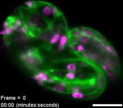 New Microscope Peers at Subcellular Gears in | EurekAlert!