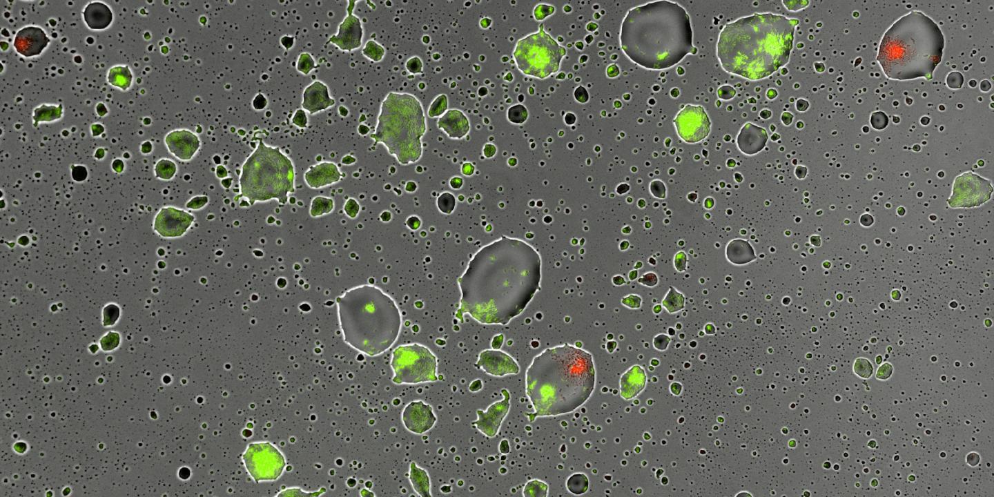 Tiny droplets allow bacteria to survive dayti | EurekAlert!