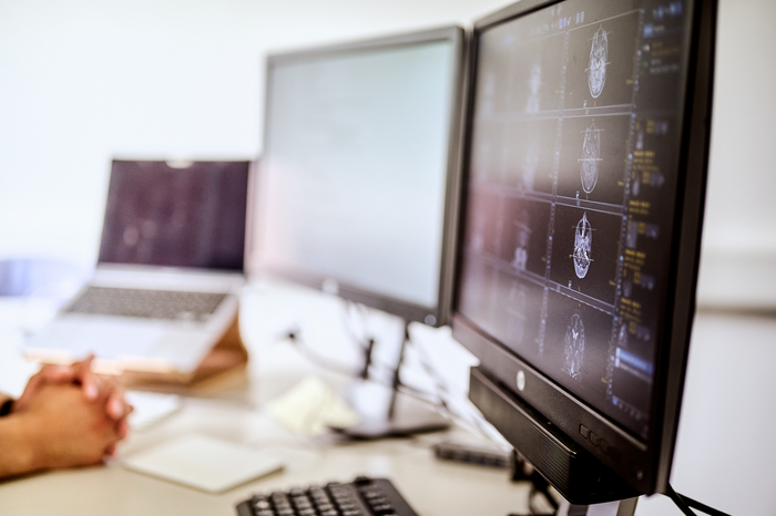 Efficient AI technology for MRI data analysis | EurekAlert!