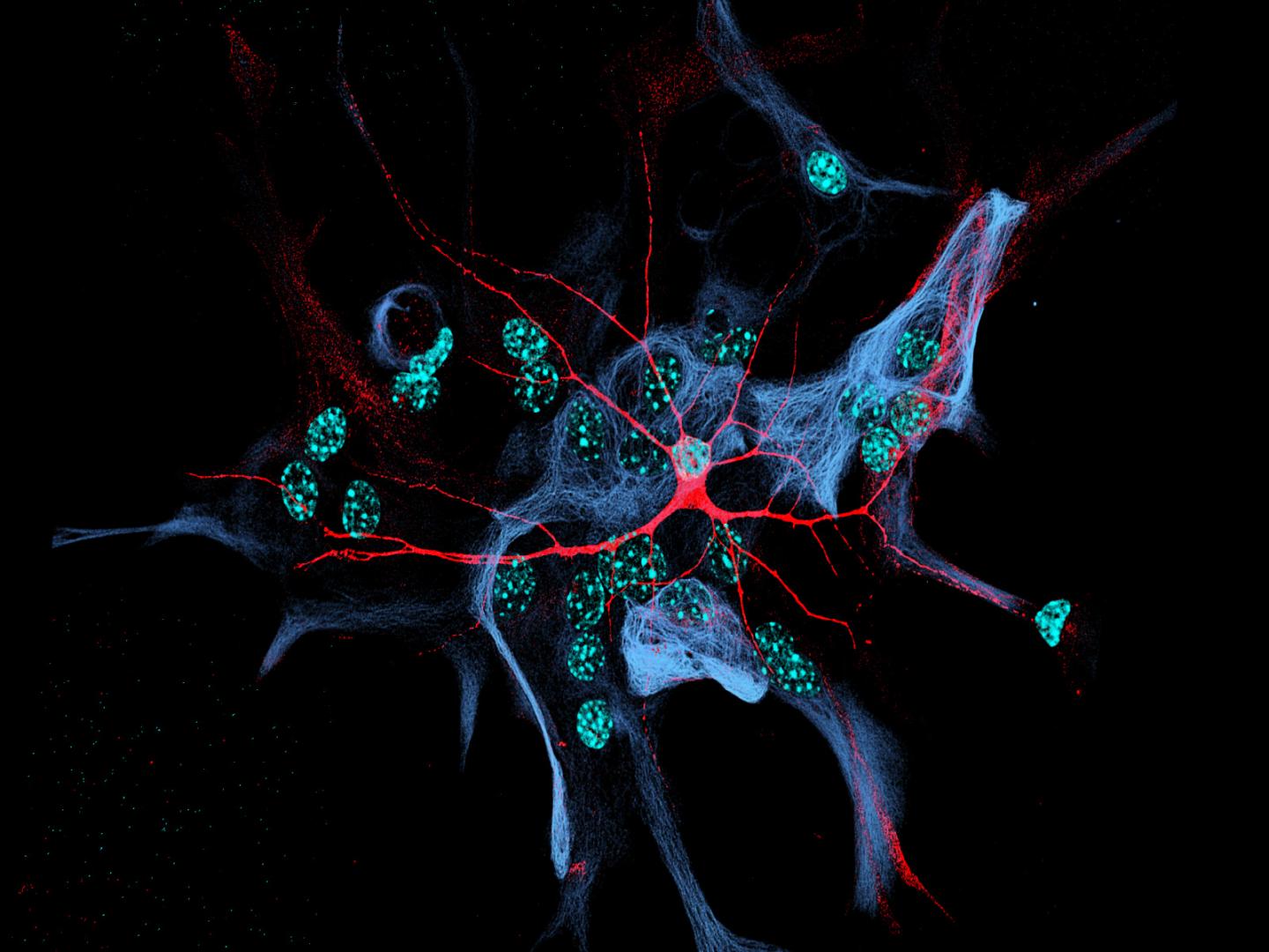 A nerve cell serves as a 'single' for studies | EurekAlert!