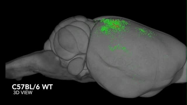 Altered Brain Connectivity May be Hallmark of | EurekAlert!