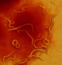 Sex Partners Give Worms the Edge in Parasite | EurekAlert!