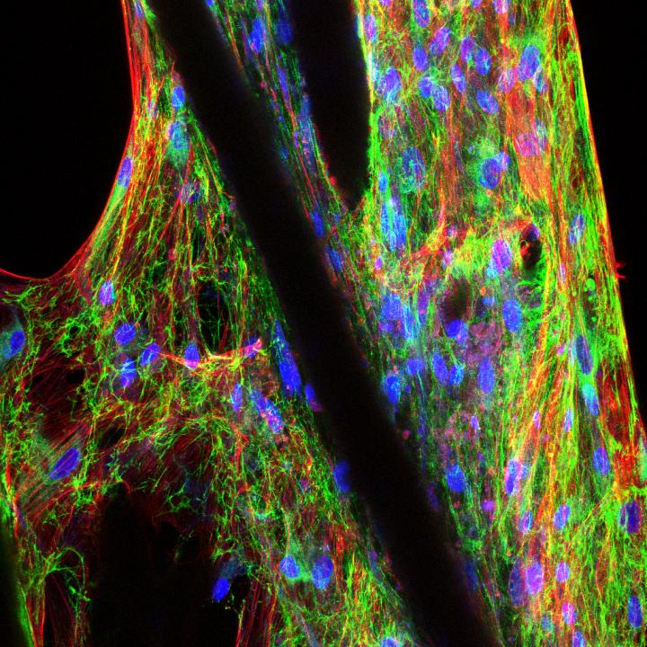 Soft-tissue engineering for hard-working cart | EurekAlert!