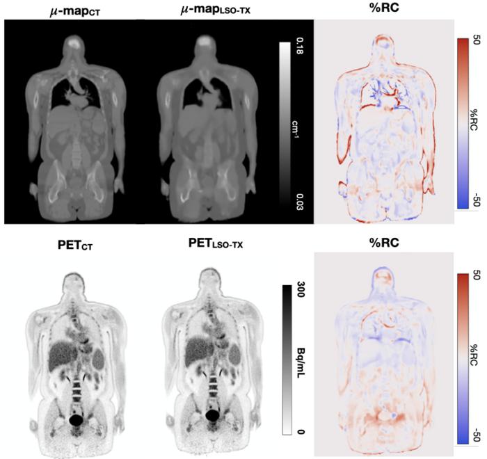 Ultra-Low-Dose PET Imaging [IMAGE] | EurekAlert! Science News Releases