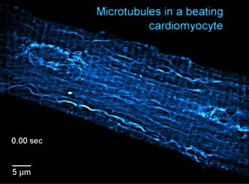 Mechanics of a heartbeat are controlled by mo | EurekAlert!