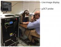 Minimally Invasive Probe Provides High-Resolu | EurekAlert!