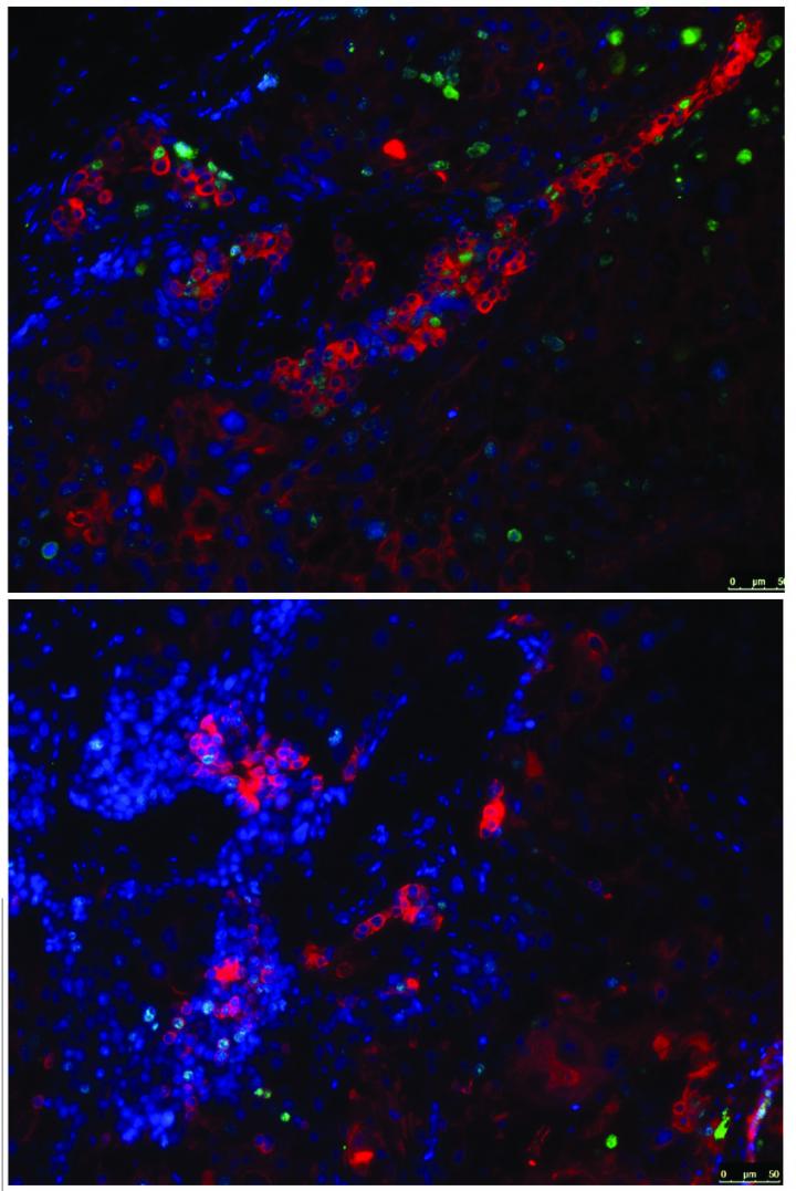 Tumor Tissue [IMAGE] | EurekAlert! Science News Releases