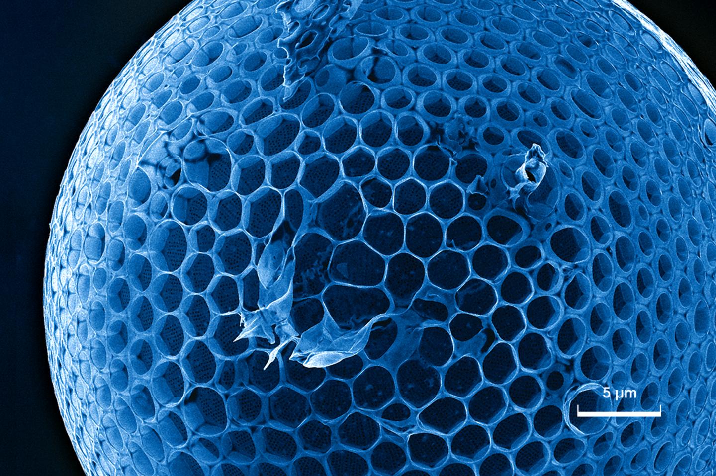 Diatom under the helium ion mi [IMAGE] | EurekAlert! Science News Releases