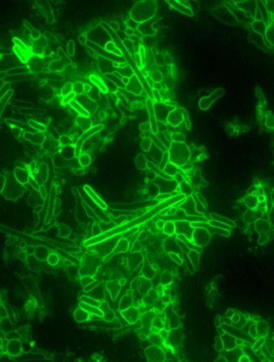 'Poisoned arrowhead' used by warring bacteria | EurekAlert!