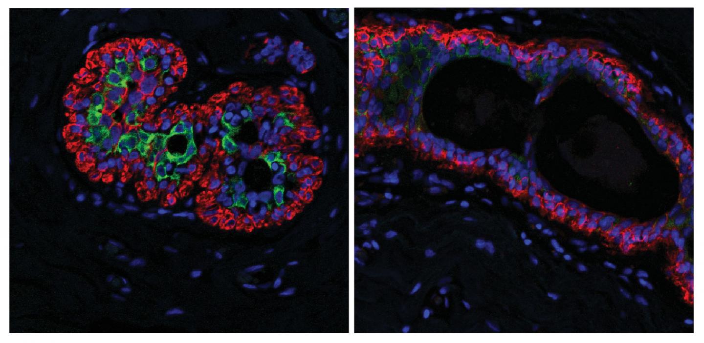 Breast Tissue [IMAGE] | EurekAlert! Science News Releases