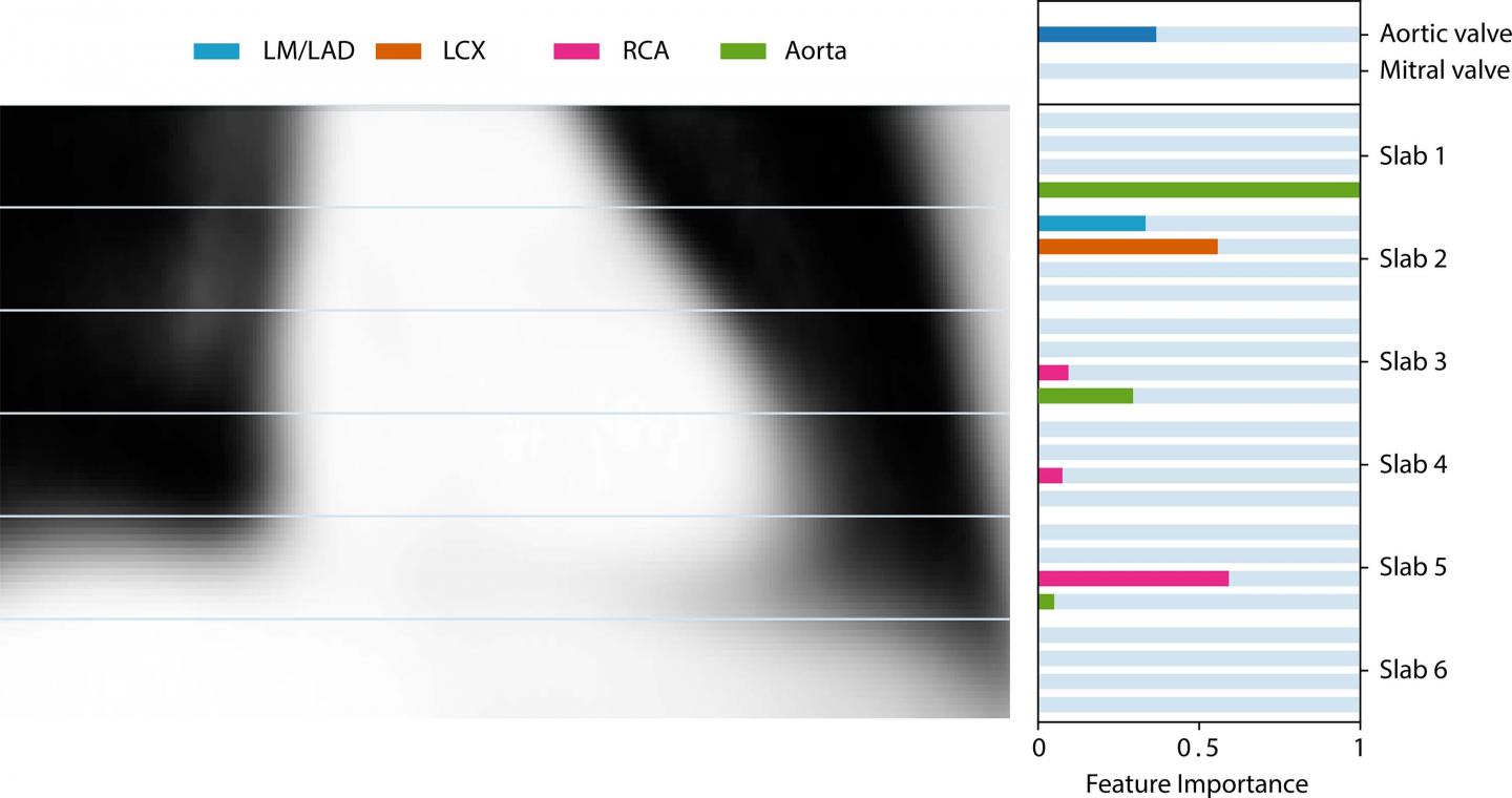 Lung Cancer Screening Predicts [IMAGE] | EurekAlert! Science News Releases