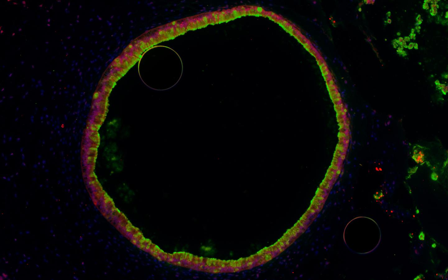 Human Intestinal Organoid [IMAGE] | EurekAlert! Science News Releases