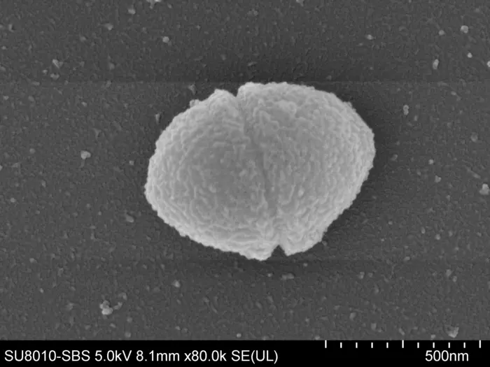 Streptococcus anginosus [IMAGE] | EurekAlert! Science News Releases
