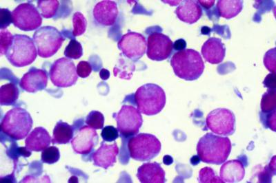 Close-Up Bone Marrow Slide 199 [IMAGE] | EurekAlert! Science News Releases