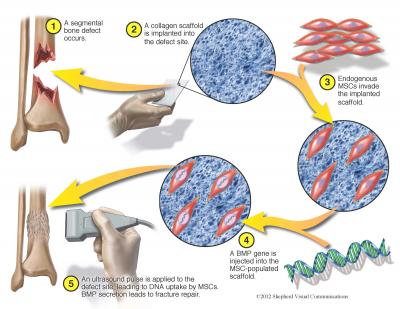 Gazit CIRM Grant Figure 1 [IMAGE] | EurekAlert! Science News Releases