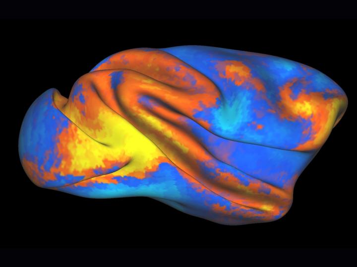 Macaque Brain [IMAGE] | EurekAlert! Science News Releases