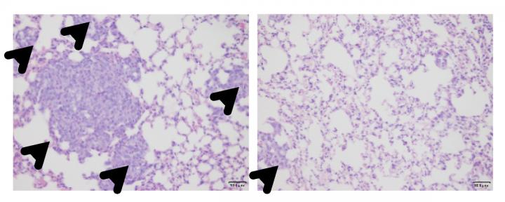 The Osteoporosis Drug Zoledron [IMAGE] | EurekAlert! Science News Releases